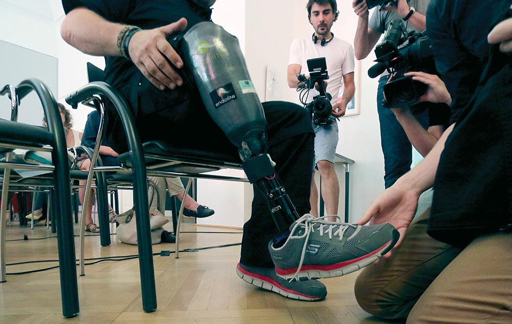 A Fake Leg That Feels | God's World News