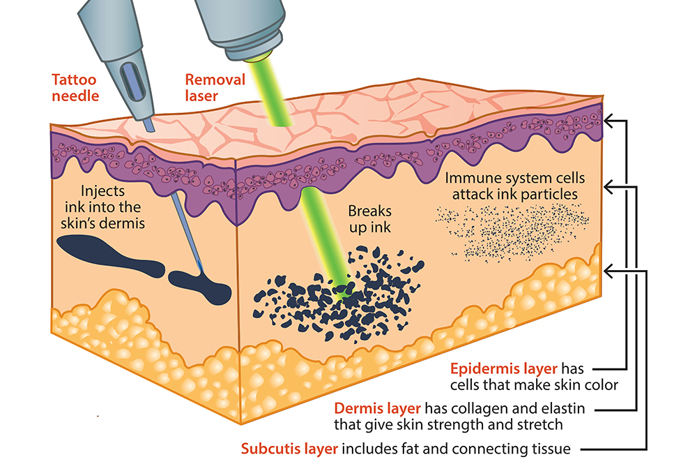 Unwanted Ink | God's World News