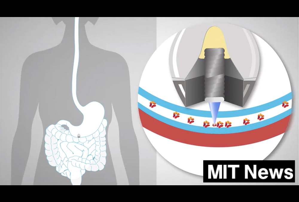 Internal Insulin Injector | God's World News