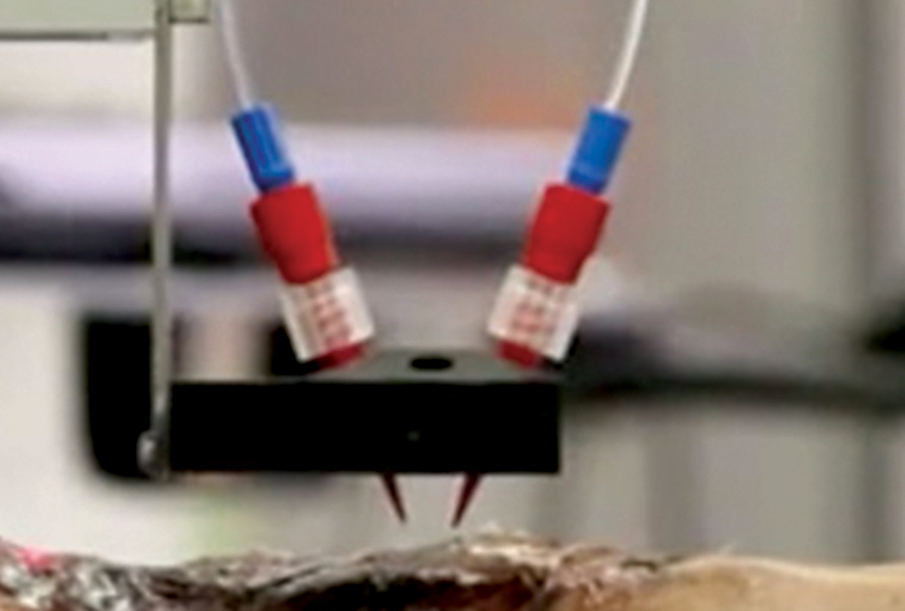 Skin Graft Printing | God's World News