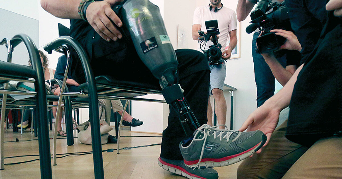 A Fake Leg That Feels | God's World News